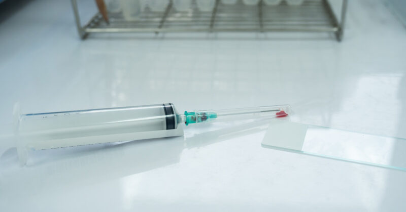 8 Benefits of an FNA Biopsy – Pathology Reference Lab | Pathology Lab ...